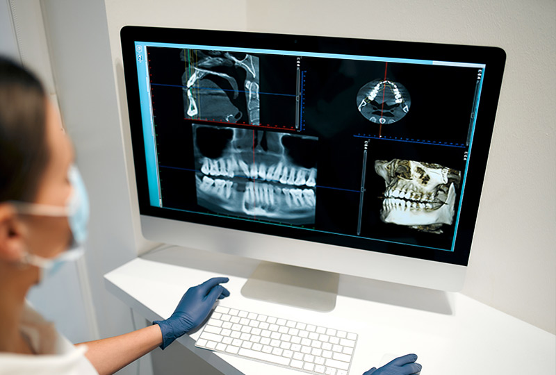 Advanced Dental Technology Grover Beach - WhiteCrest Smart Dentistry